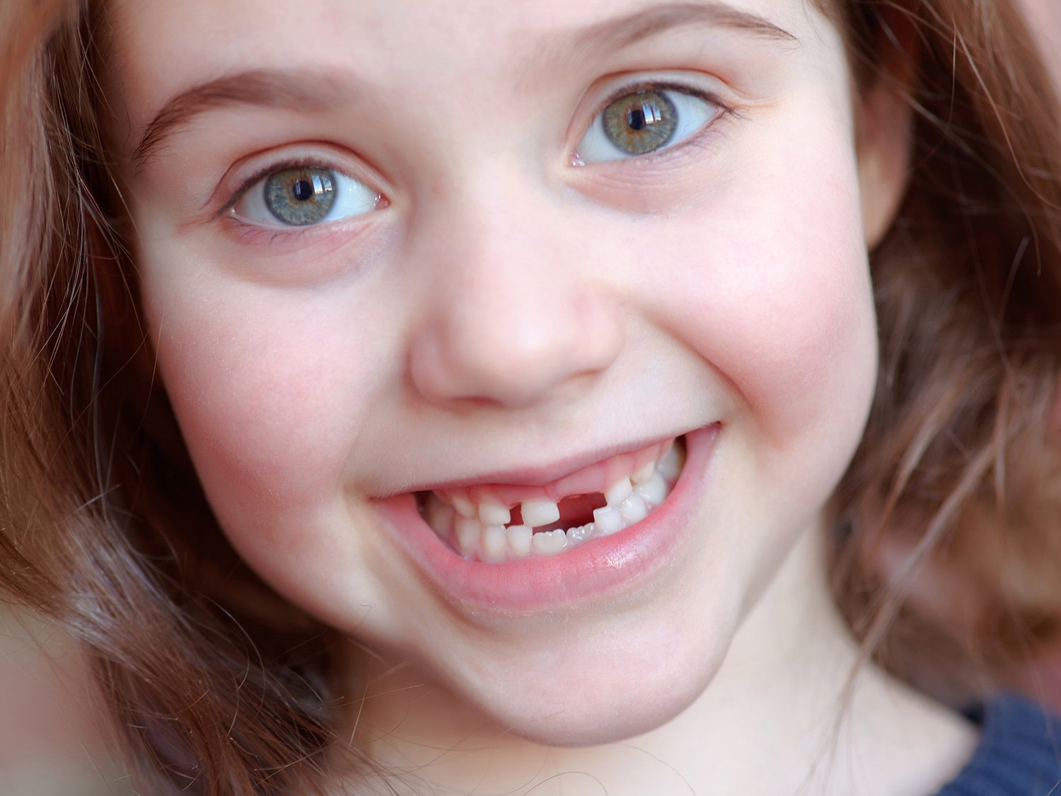 Big Day: "I Lost My Tooth!"